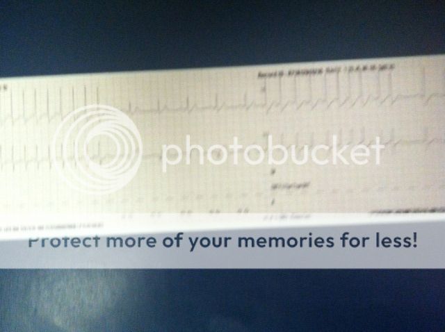 Weird EKG.... Have at it! | EMTLIFE