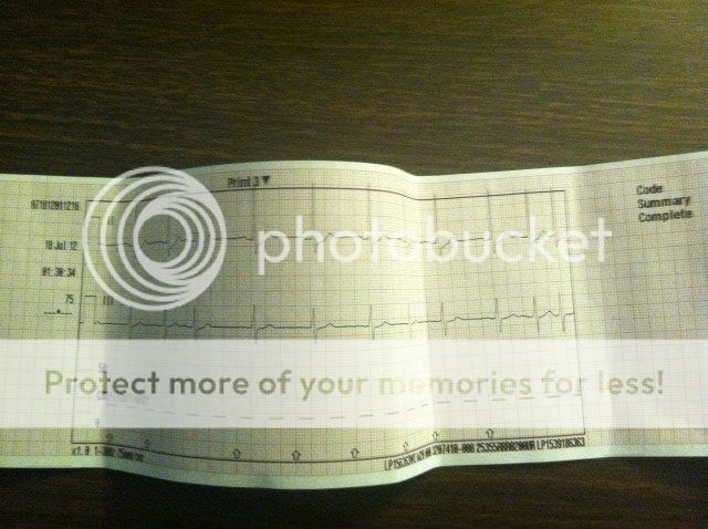 Weird EKG.... Have at it! | EMTLIFE